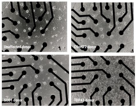 Multielectrode Array Characterization Of Human Ipsc Derived Motor
