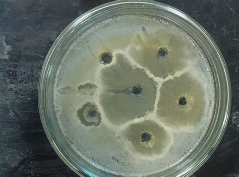 321 Questions With Answers In Bacteriological Techniques Science Topic