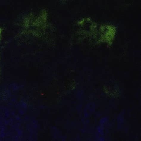 Automated Identification And Localization Of Hematopoietic Stem Cells In 3d Intravital