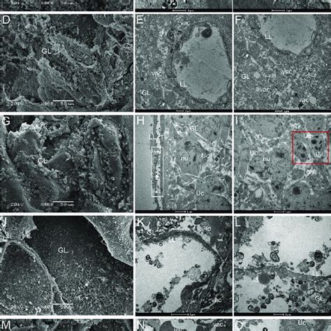 Ultrastructural Alterations Of Metacestodes In Different Treatment