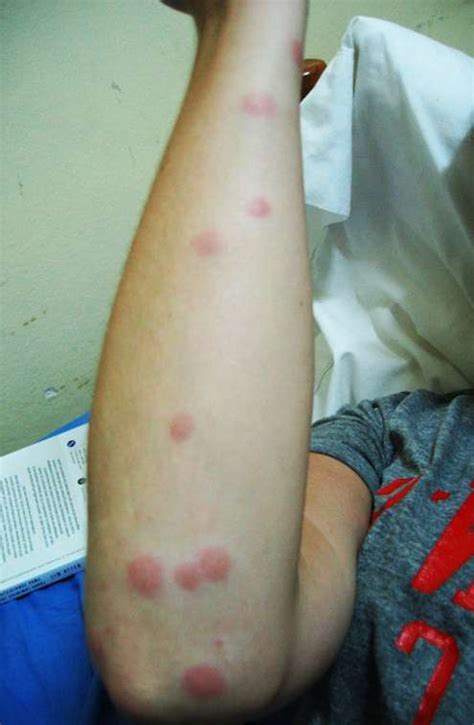 What Do Flying Termites Look Like In Australia