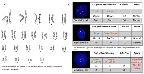 A Karyotype Revealed A Normal Set Of Whole Chromosomes Consistent
