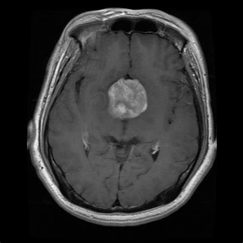 Stuti Thakur Stuti Thakur 1glig Roboflow Universe