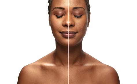 Facelift Before And After Results What To Expect From A Deep Dr Deon