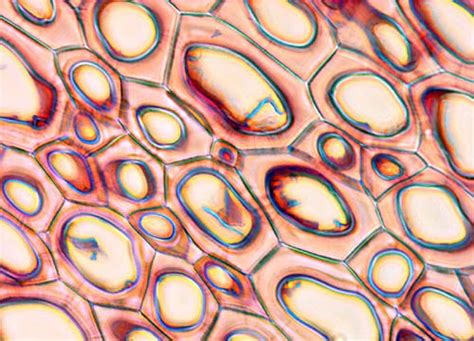 Plasmodesmata Nikons Microscopyu