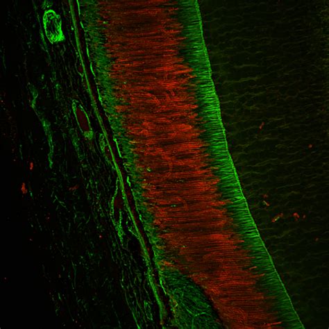 Echo Spinning Disk Confocal Microscope