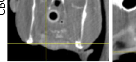 [pdf] Sentinel Lymph Node Mapping Using Icg Fluorescence And Cone Beam