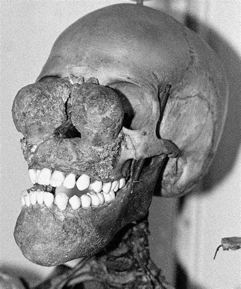 Deez Nuts Album On Imgur