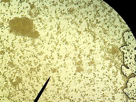 Yogurt Under Microscope