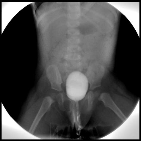 Digital X Ray Breach Candy Hospital Trust Digital X Ray Breach Candy Hospital Trust