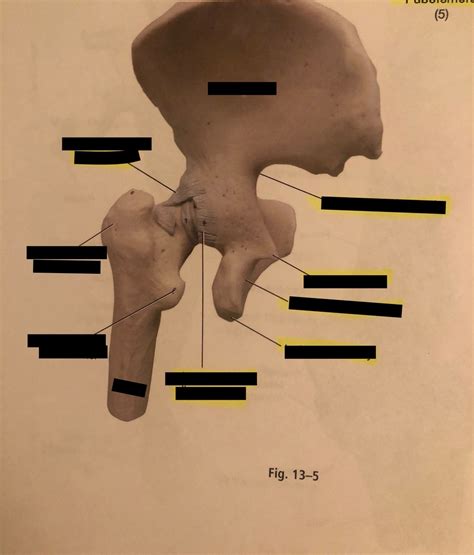Lower Limb Posterior Hip Diagram Quizlet