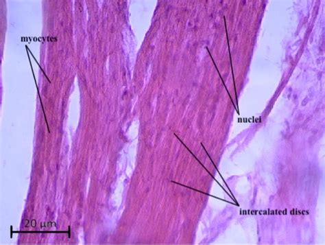 Solved Write A Microscopic Description Using The Hande Stains