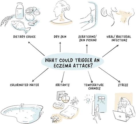 A Chart About Eczema With Gvc Style Art Rgvcdesign