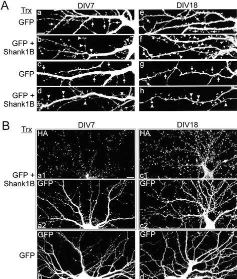 Figure 1 From Regulation Of Dendritic Spine Morphology And Synaptic