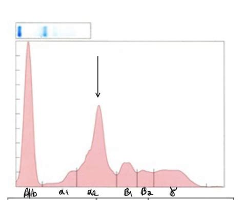 Proteins Flashcards Quizlet