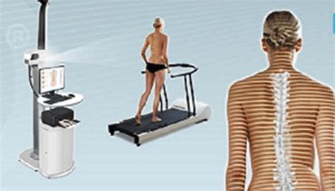 Diers Formetric 4d System Consent From Diers International Gmbh Download Scientific Diagram