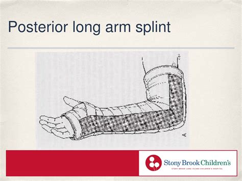 Ppt Comprehensive Guide To Splinting Techniques For Orthopedic