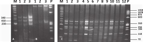 Restriction Fragment Length Polymorphism Analysis Of 1246 Bp Fragment