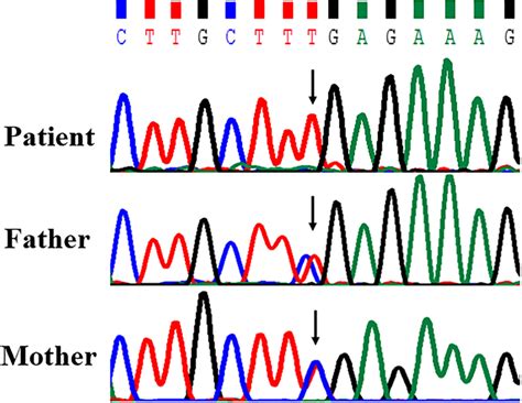 Simple Explanation Of Sanger Sequencing At Lyn Romano Blog