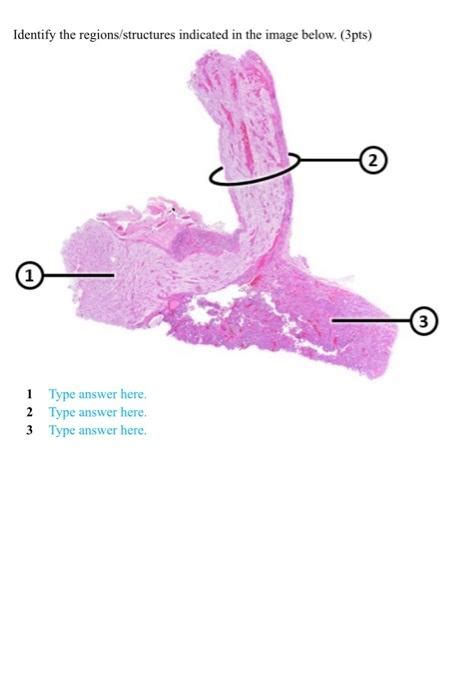 solved identify the regions structures indicated in the