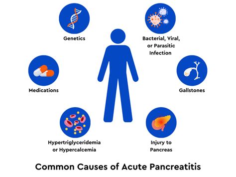 Acute Pancreatitis Mission Cure