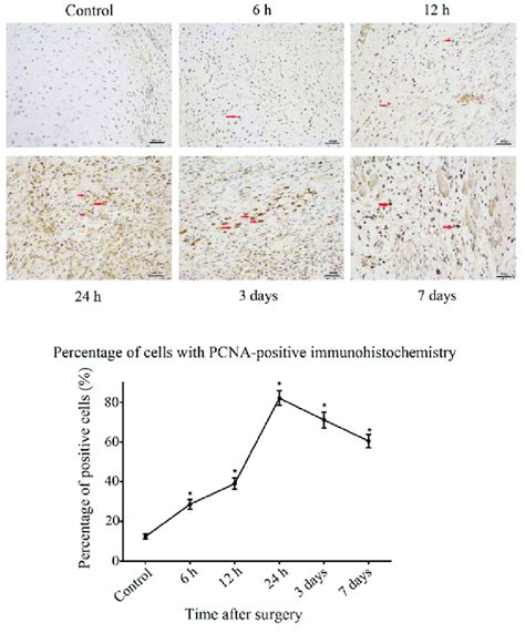 Immunohistochemical Staining Of Pcna In Controls And At Each Time Point