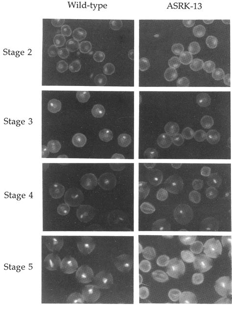 Dapi Staining Of Microspores Of A Wild Type Plant And Asrk 13 At