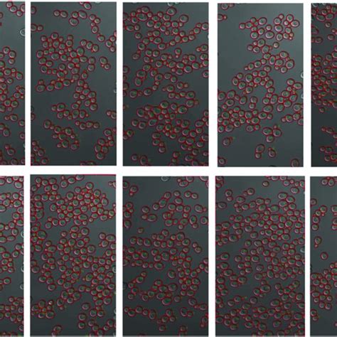 Example Of Yeast Cells Segmentation First Column Raw Dic Image Download Scientific Diagram
