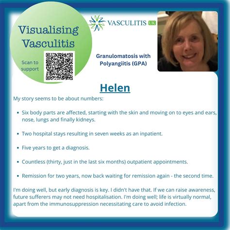 Diagnostic Vasculitis Patients Raredisease Diagnosis Patient