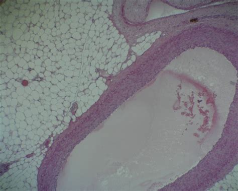 He1006559 Prepared Microscope Slide Aorta And Vein Ts Findel