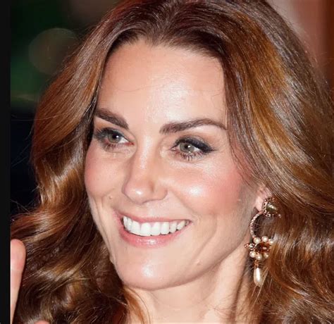 👸 Kate Middletons Teeth A Royal Transformation Lema