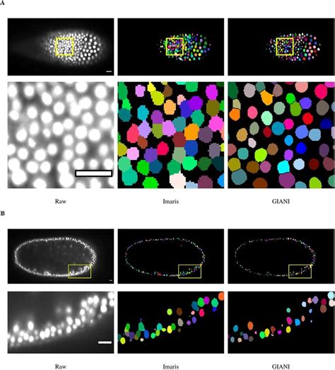 Demonstration Of Giani On A Large Light Sheet Microscopy Dataset Download Scientific Diagram