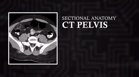Ct Pelvis Axial Video Lesson Clover Learning