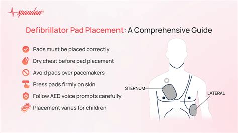 Anteroposterior Aed Placement Defibrillator Pad Placement Where Do