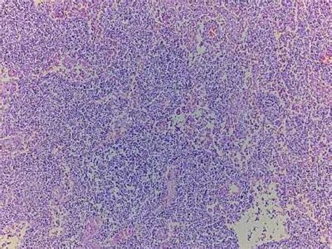 Novus Biologicals Lymph Node Tissue Slides Adult Normal Paraffin 5