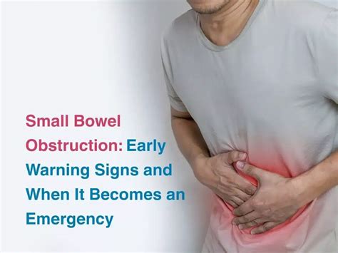 Small Bowel Obstruction Early Warning Signs And When It Becomes An