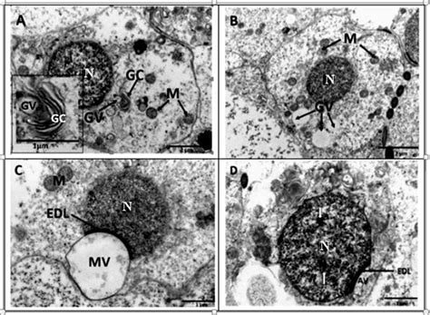Spermiogenesis In The African Sideneck Turtle Pelusios Castaneus