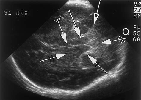 A New View Of The Neonatal Brain Clinical Utility Of Supplemental