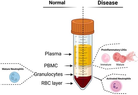 Low Density Granulocytes Ldgs Colocalize With Mononuclear Cells Download Scientific Diagram