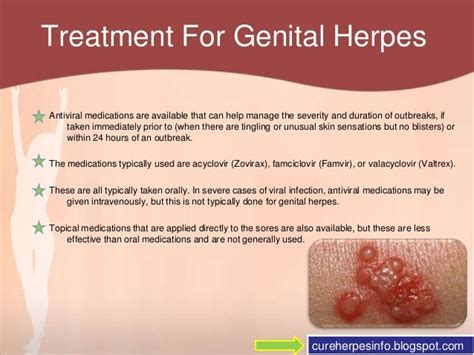 Genital Herpes Men Treatment