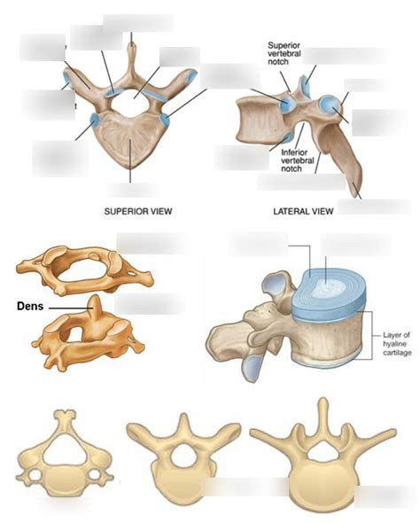 Diagram Of Block 5 Vertebra 1 Quizlet