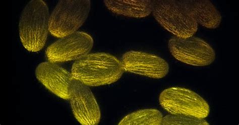 Peace Lily Pollen Spores 40x Imgur