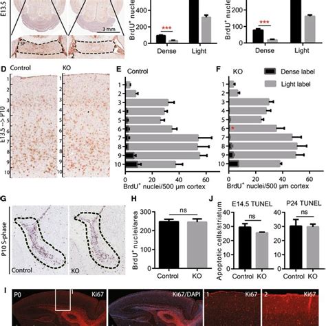 Ventricular Dilation In The Mutant Brain Due To Septal And Striatal Download Scientific Diagram