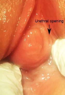 Skenes Gland Wikipedia