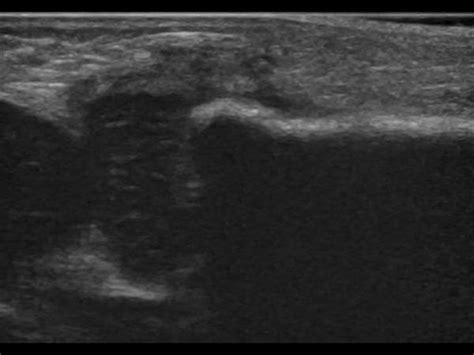 Musculoskeletal Bone Muscle Nerves And Other Soft Tissues 71 Bone