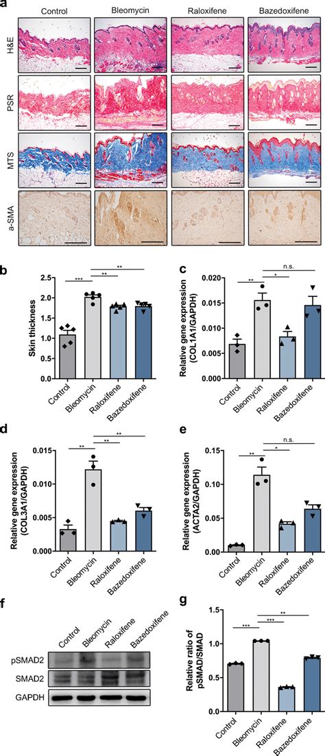 Anti Fibrotic Effects Of Raloxifene In The Bleomycin Induced Model Of