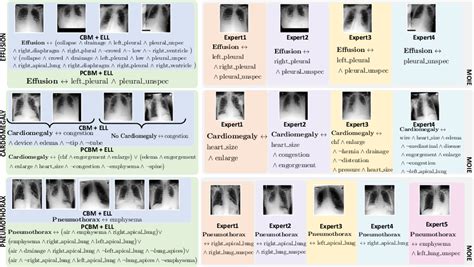 Figure 2 From Distilling Blackbox To Interpretable Models For Efficient Transfer Learning