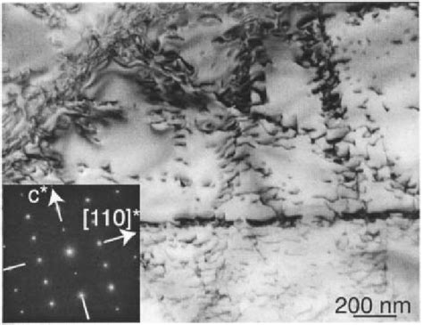 Bright Field Image Displays The Very High Density Of Dislocations In