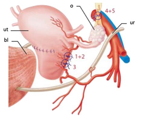 การรักษาภาวะตกเลือดหลังคลอด Update Management Of Postpartum