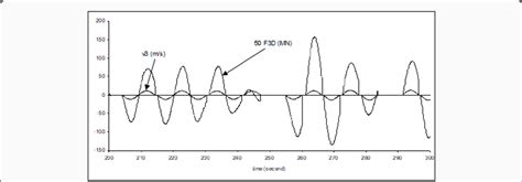 The Velocity And Exciting Force Of Heaving Vertical Cylinder At Natural